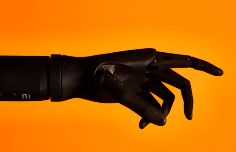 World medical star brought to Lviv new prosthetic technology for ...